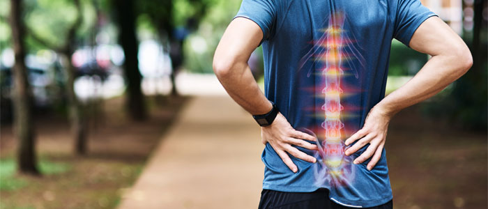 5 Signs You Have a Bulging Disc - Albuquerque NM